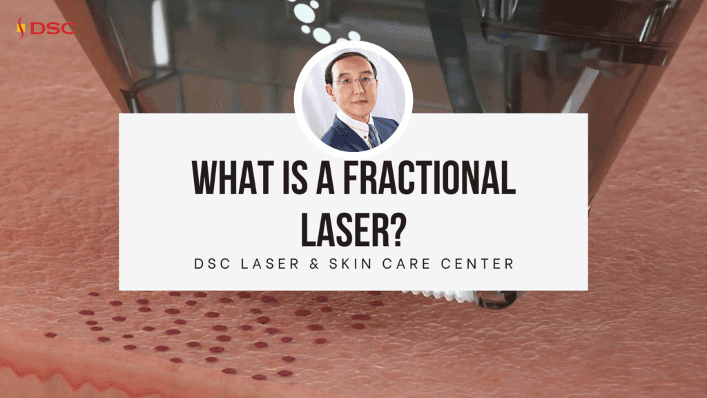 What is a Fractional Laser? - DSC Laser & Skin Care Center