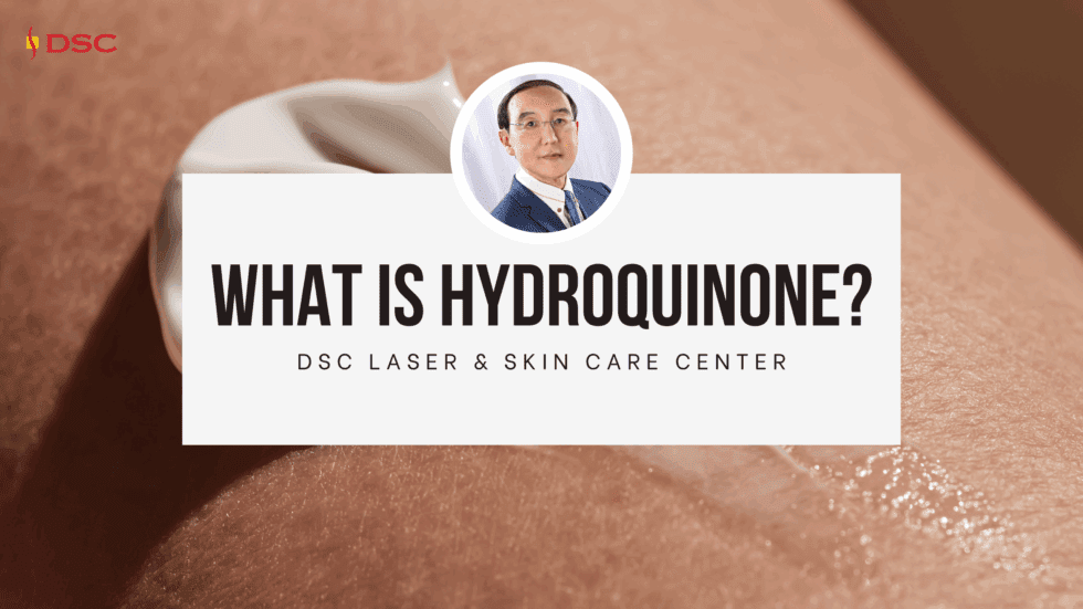 What is Hydroquinone? - DSC Laser & Skin Care Center